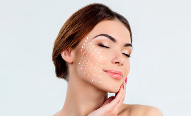 Thread Lift – Indian Association Of Aesthetic Plastic Surgeons